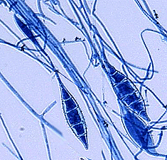 Ringworm - Mar Vista Animal Medical Center
